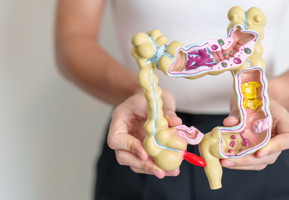 Bowel Cancer Screening in Wales - Cancer Research Wales